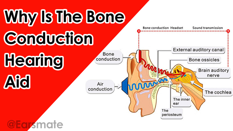 Why Do You Need The Bone Conduction Hearing Aids - Earsmate